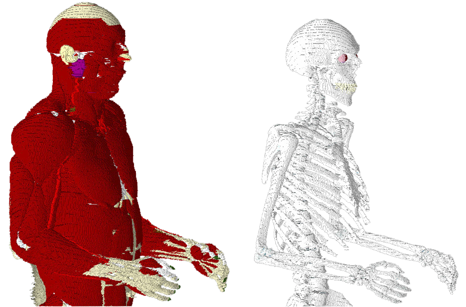 XFdtd VariPose® Biological Mesh Repositioning | Remcom