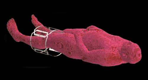 Computation of Fields and SAR for MRI with FDTD Simulation | Remcom