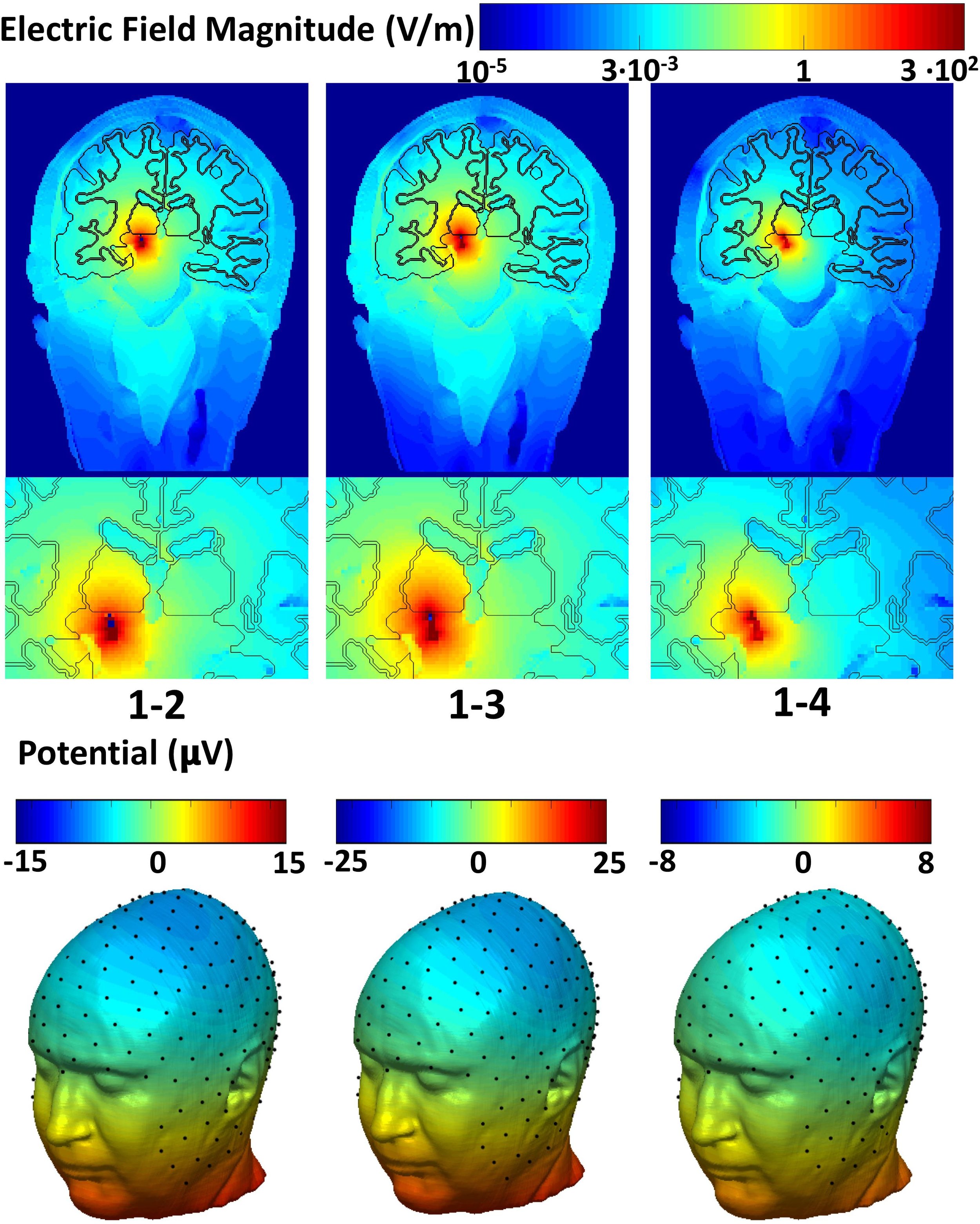 A Study on the Feasibility of the Deep Brain Stimulation (DBS ...